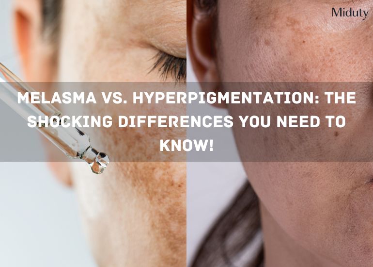 Hyperpigmentation vs Melasma: Key Differences and Treatments - Miduty